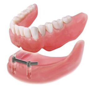 Klikgebit - Dental Center